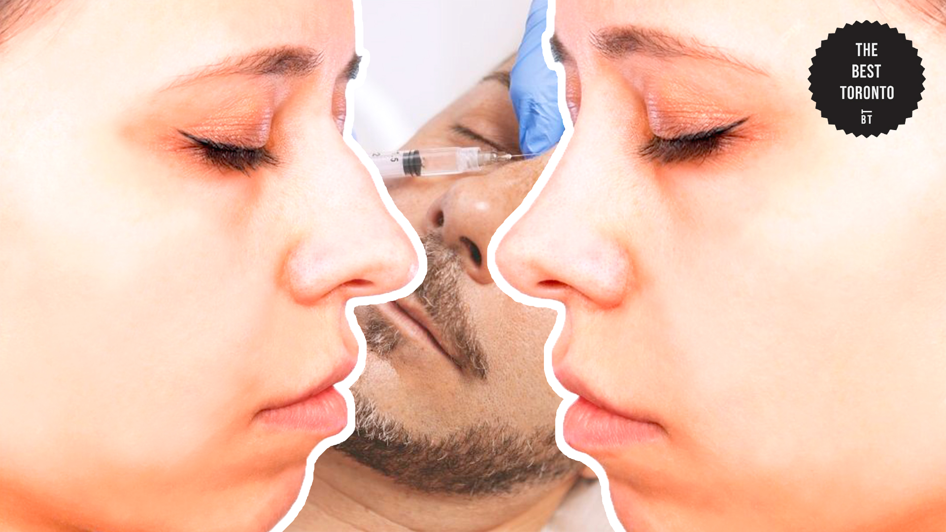 Rhinoplasty Procedures in Toronto: Uncovering the Types