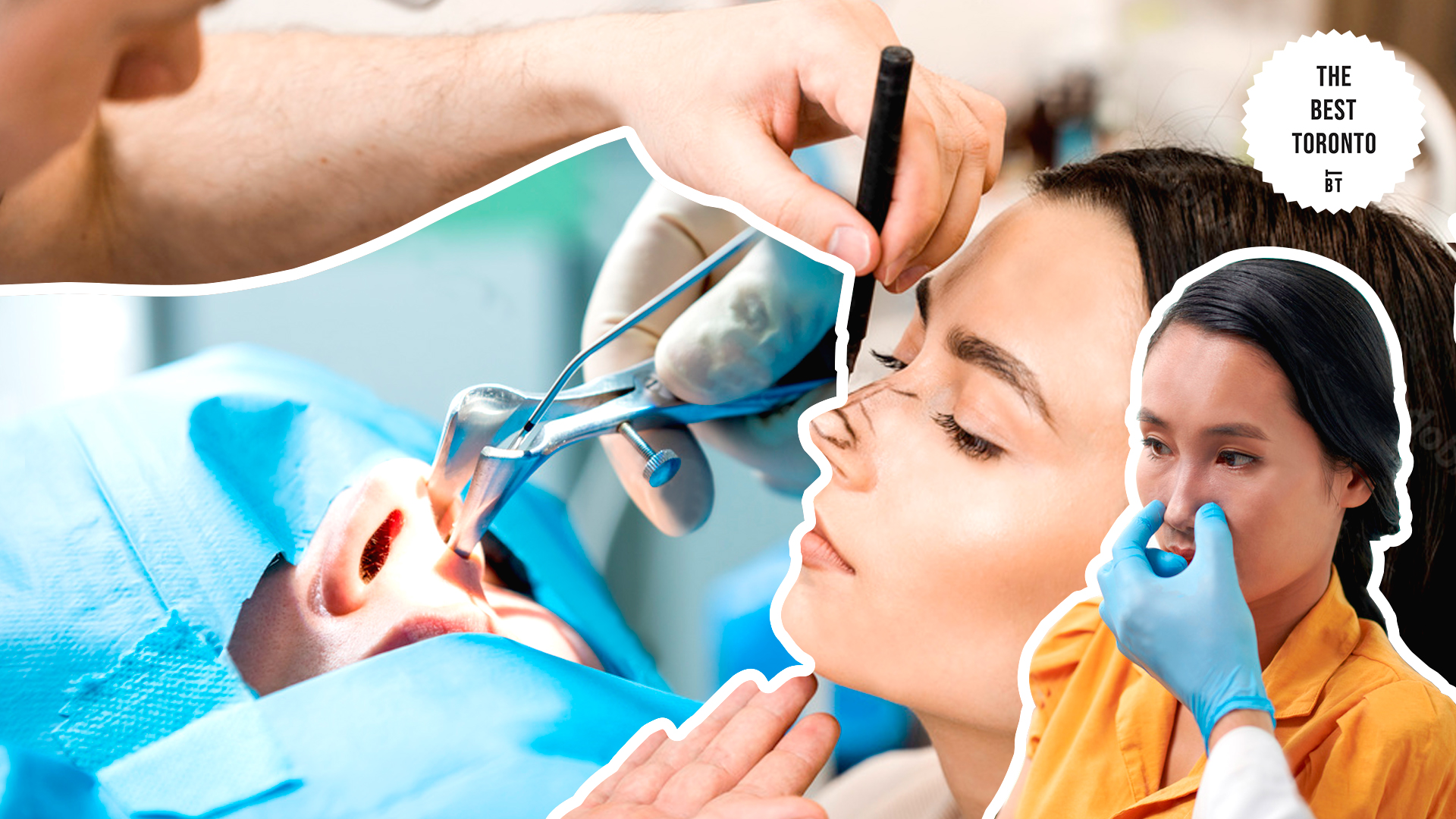 Rhinoplasty Procedures in Toronto: Uncovering the Types